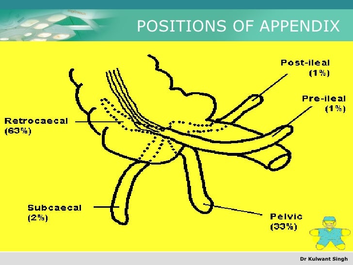 Early Tip Appendicitis Pathology
