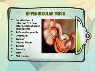 Appendicitis- a simplistic view for GPs | PPTX