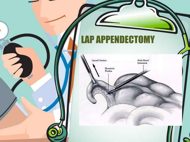 Appendicitis- a simplistic view for GPs | PPT