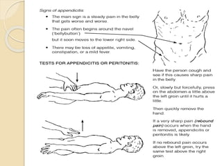 Appendicitis | PPTX