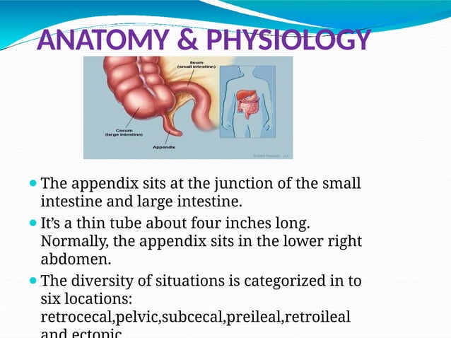 APPENDICITIS 2.pptx7777777777777777777777777777777777 | PPT