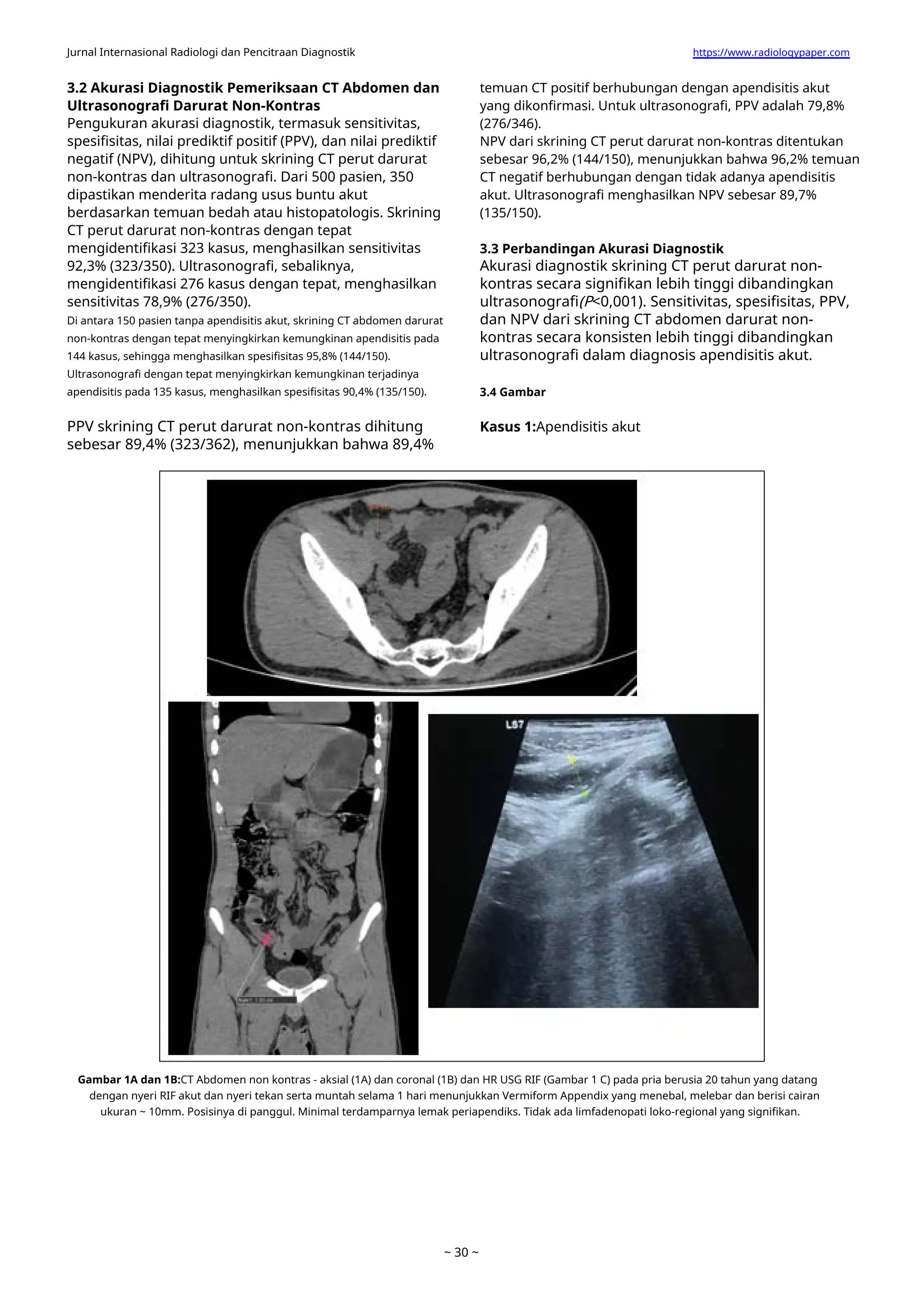 kasus appendicitis akut di rs india -bentuk case review | PDF