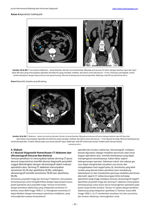 kasus appendicitis akut di rs india -bentuk case review | PDF