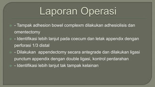 Appendicitis Anak.pptx