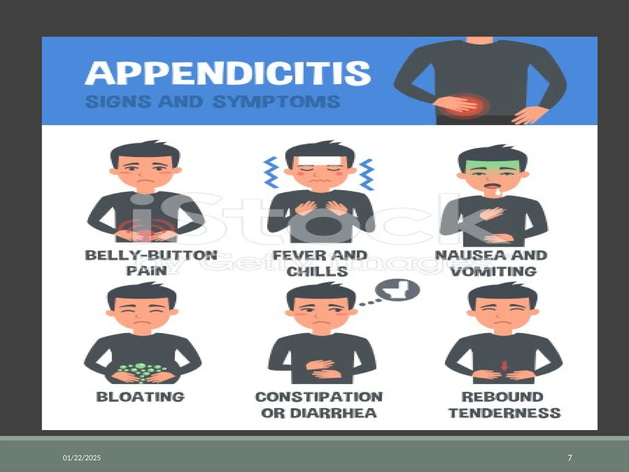 Appendicitis and peritonitis 2019 (1).pptx