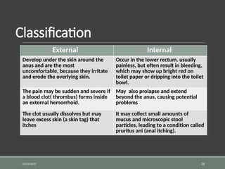Appendicitis and peritonitis 2019 (1).pptx