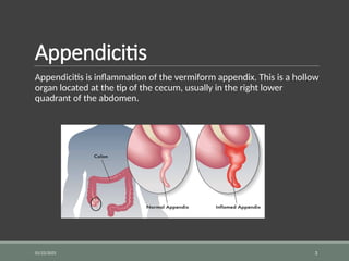 Appendicitis and peritonitis 2019 (1).pptx