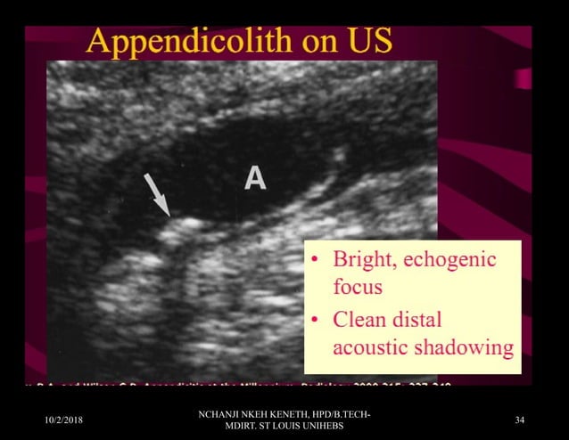 Appendicitis and role of ultrasound scan in diagnosis Nchanji Nkeh ...