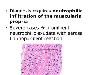 Appendicitis and tumors of appendix mbbs | PPTX