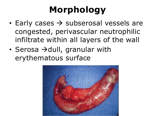 Appendicitis and tumors of appendix mbbs