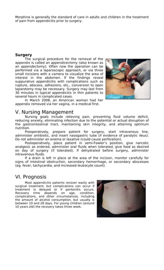 appendicitis_compress.pdf