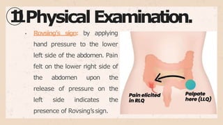 Appendicitis D6.pptx