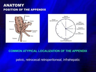 Appendicitis DELV.ppt
