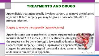 Appendicitis - a detailed medical study | PPTX | Digestive Disorders ...