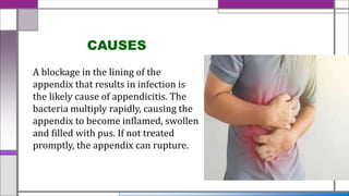 Appendicitis - a detailed medical study | PPTX | Digestive Disorders ...