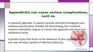 Appendicitis - a detailed medical study | PPTX | Digestive Disorders | Diseases and Conditions