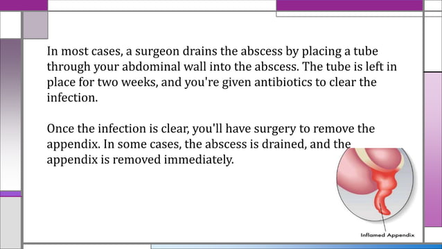 Appendicitis - a detailed medical study | PPTX | Digestive Disorders ...