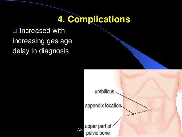 Appendicitis During Pregnancy