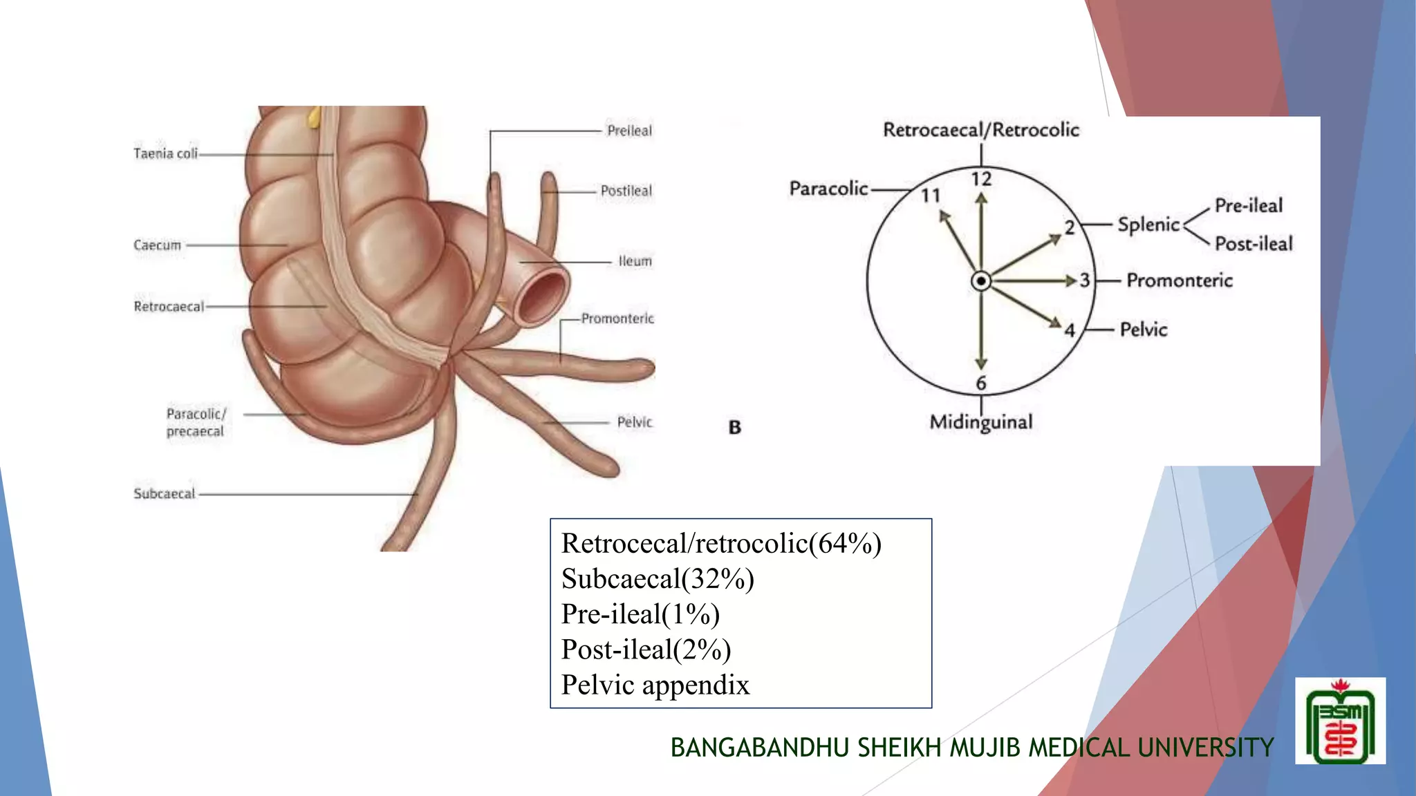 Appendicitis in children | PPTX