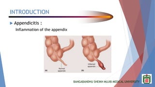 Appendicitis In Children