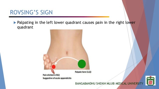 Appendicitis in children