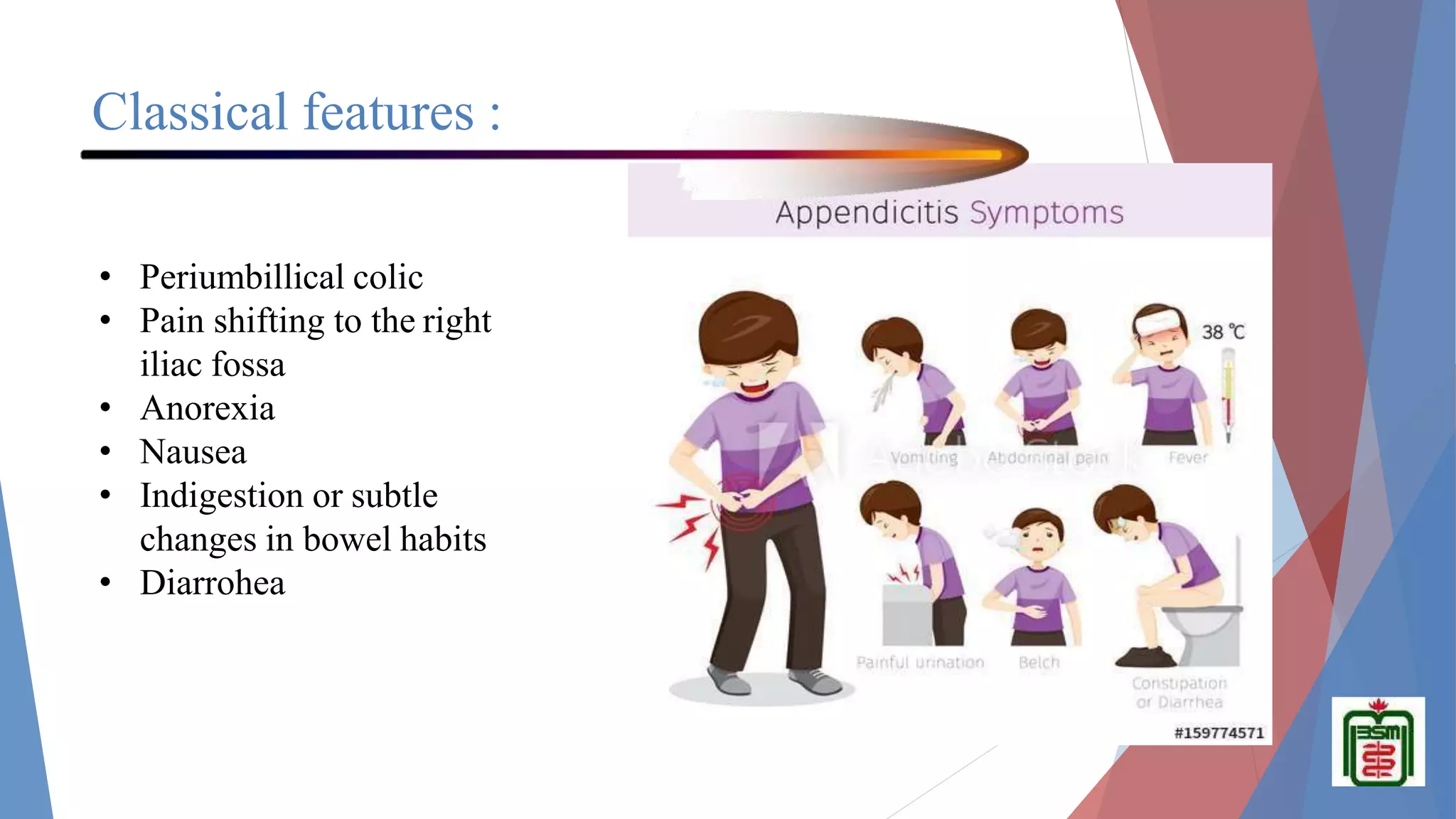 Appendicitis in children-.pptx