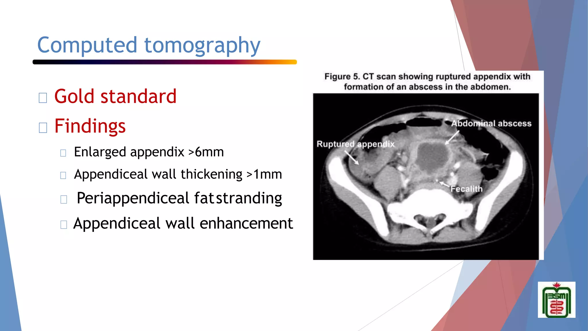 Appendicitis in children-.pptx