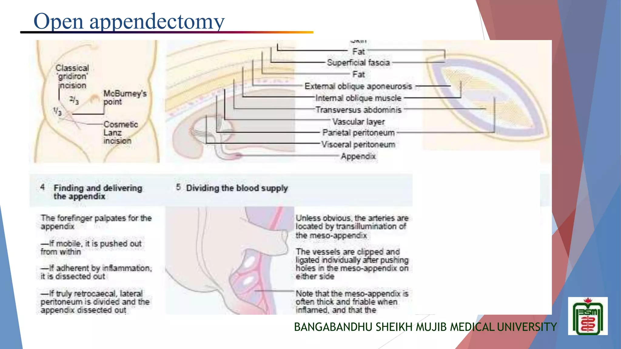 Appendicitis in children-.pptx