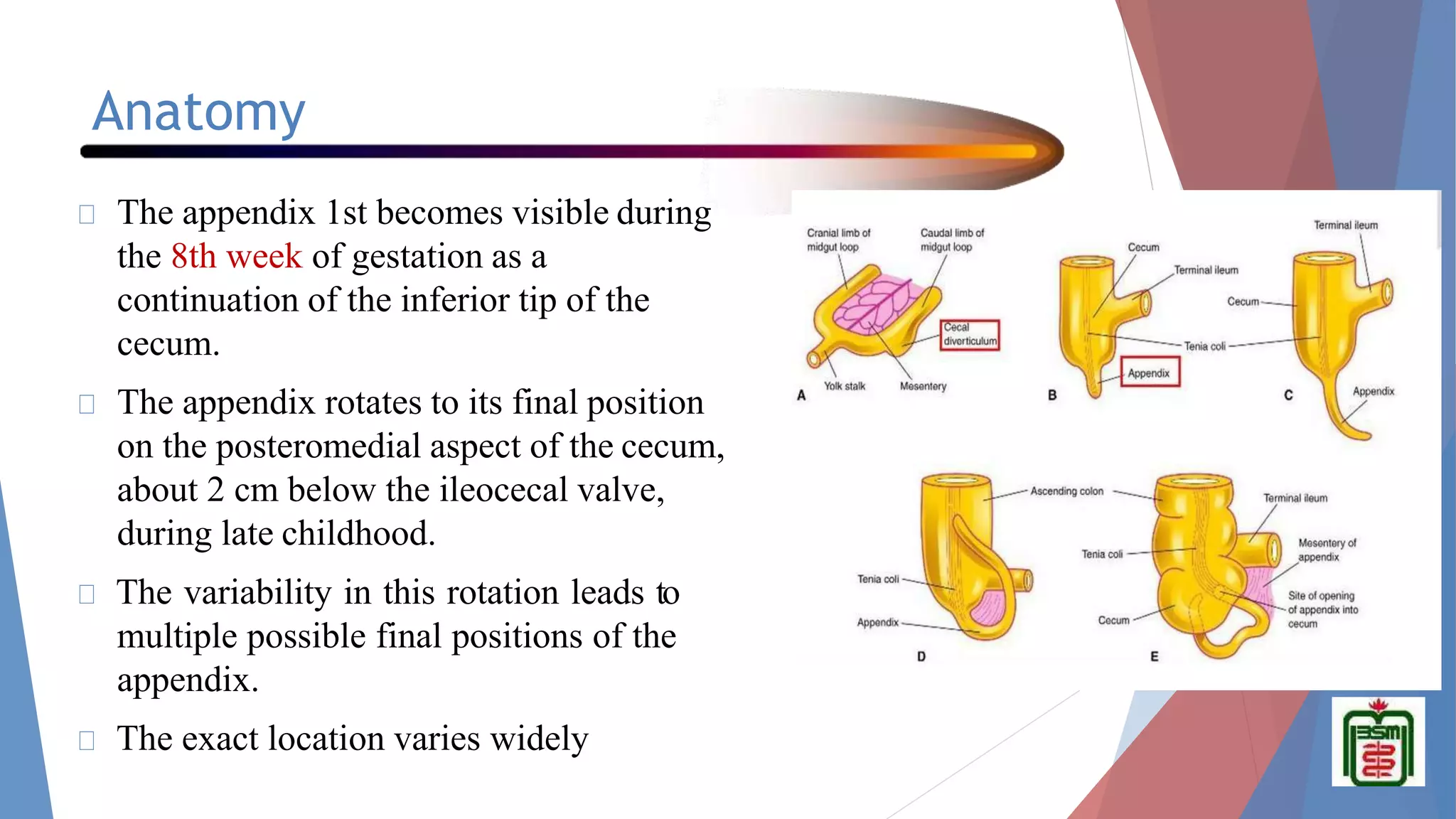 Appendicitis in children-.pptx