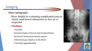 Sentinel Loop Appendicitis