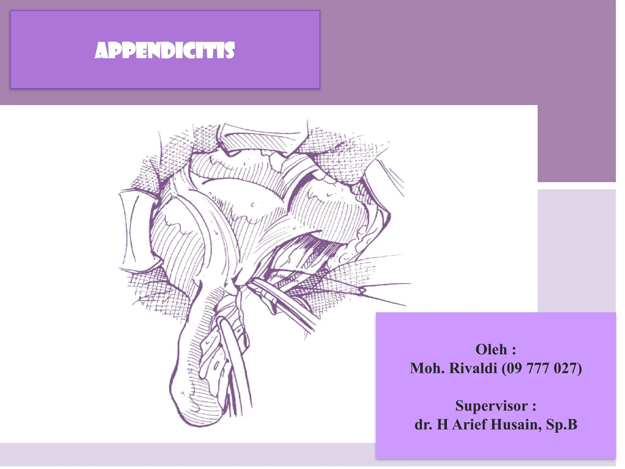 Appendicitis perforated presentation medical.pptx