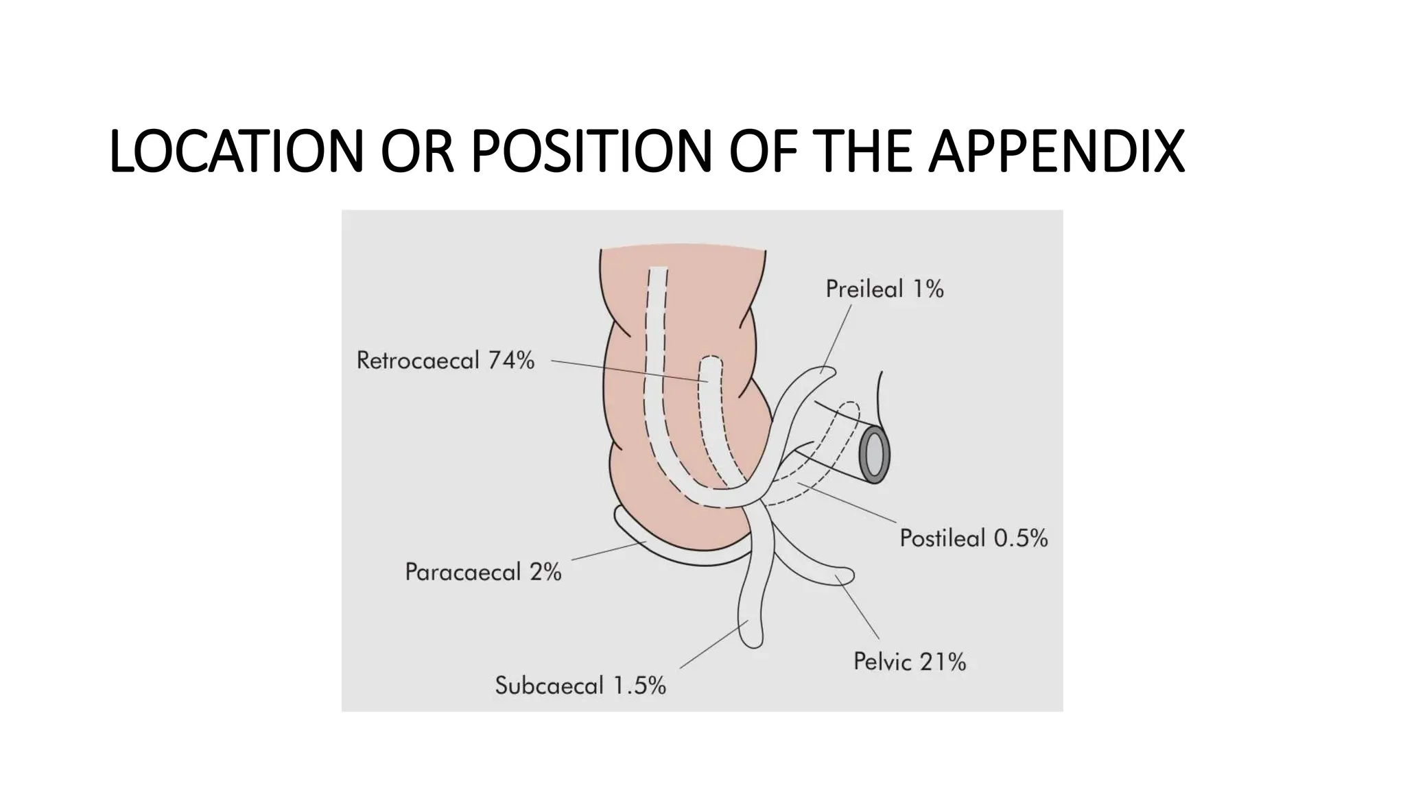 APPENDICITIS power point presentations.pptx