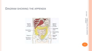 APPENDICITIS PP.pptx