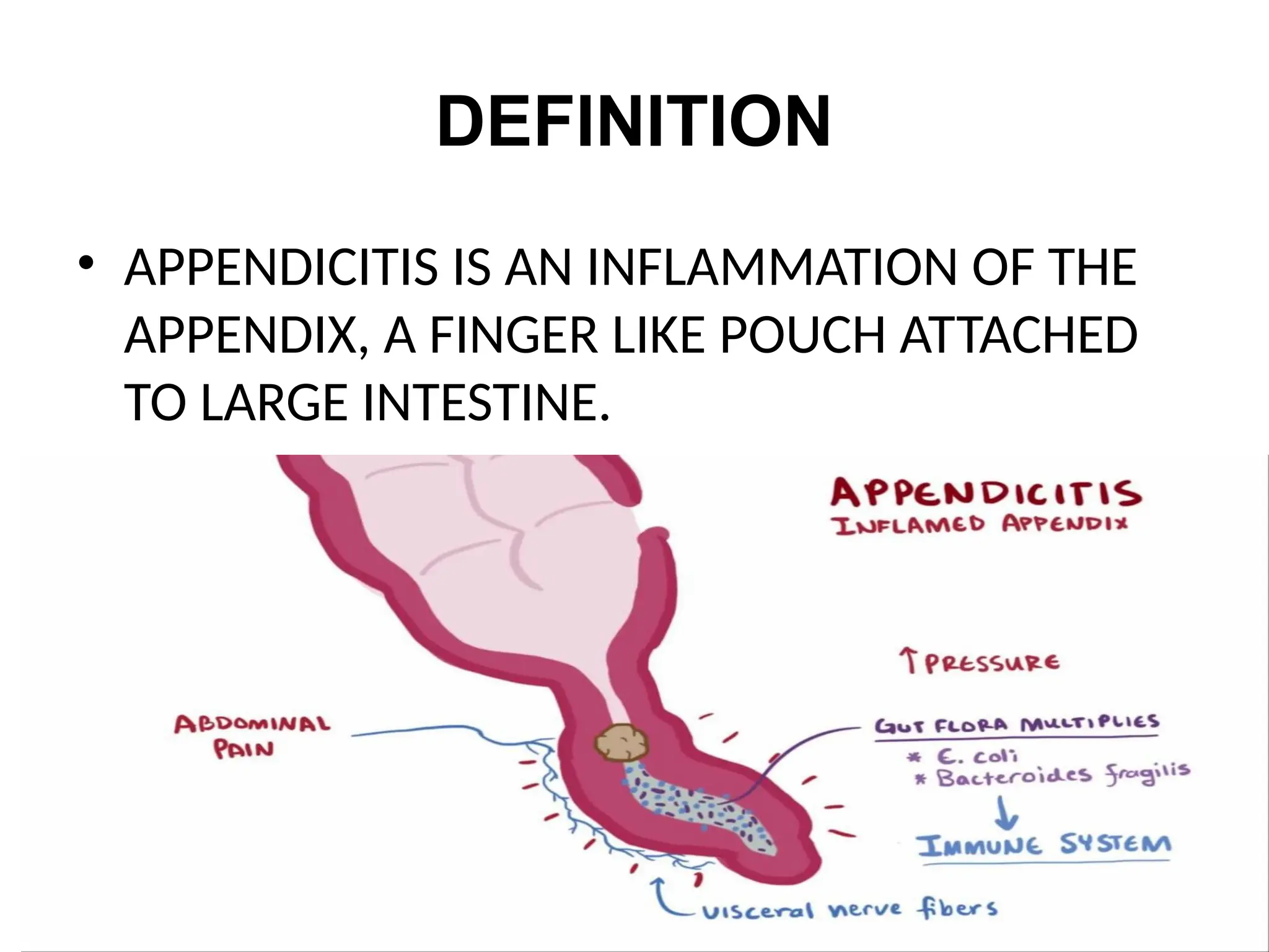 ACUTE APPENDICITIS PPT [Autosaved].pptx