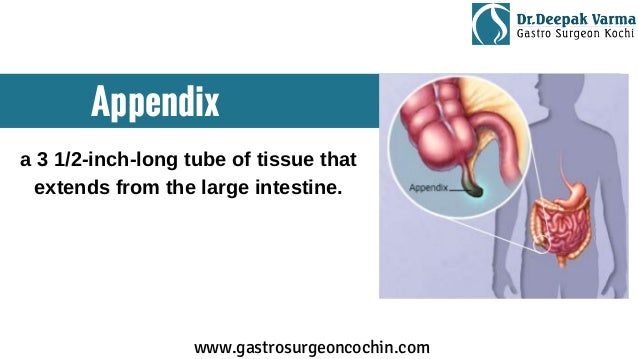 Appendicitis Treatment In Cochin | Appendix Operation In Kerala