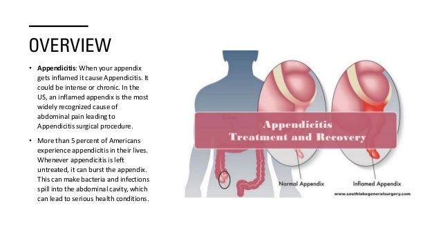 Appendicitis Symptoms, Treatment, and Recovery.pdf