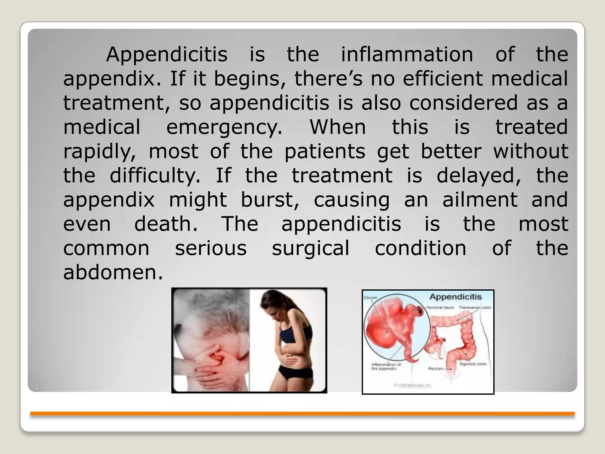 Appendicitis the drugless treatment | PPTX