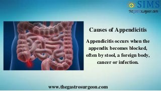 Appendicitis Treatment In Chennai | Appendix Removal Surgery In Tamil Nadu