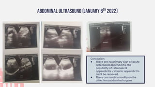 Appendicogram - Kontras - LOV TIA WIS.pptx