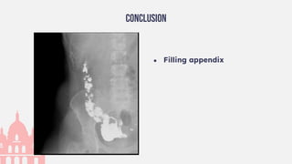 Appendicogram - Kontras - LOV TIA WIS.pptx