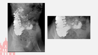 Appendicogram - Kontras - LOV TIA WIS.pptx
