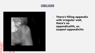 Appendicogram - Kontras - LOV TIA WIS.pptx