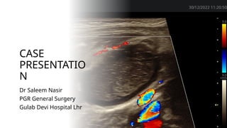 APPENDICULAR ABSCESS by Dr Saleem Nasir at Gulab Devi Hospital Lahore.pptx