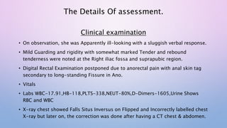 appendicular mass.pptx