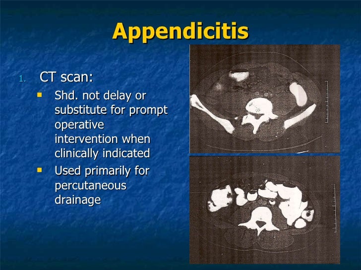 Appendix Surgery