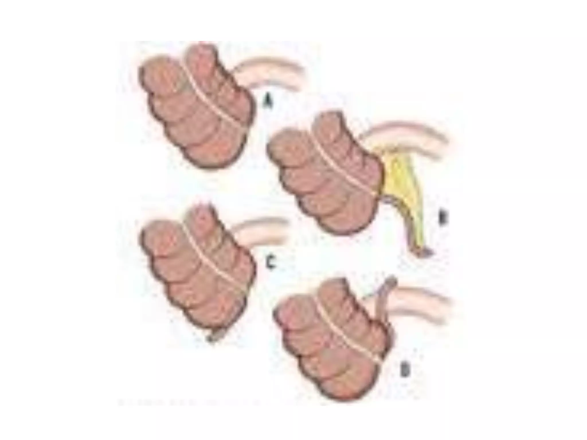 Appendix | PPTX | Pregnancy | Reproductive Health