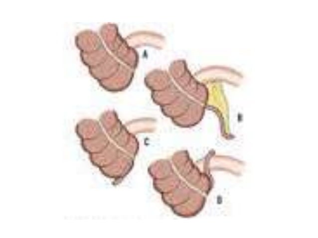 Appendix | PPTX | Pregnancy | Reproductive Health