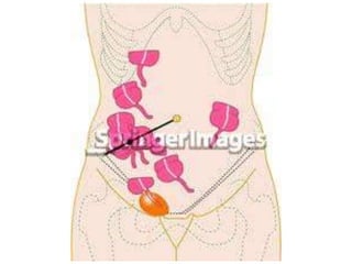 Female Abdominal Anatomy Appendix
