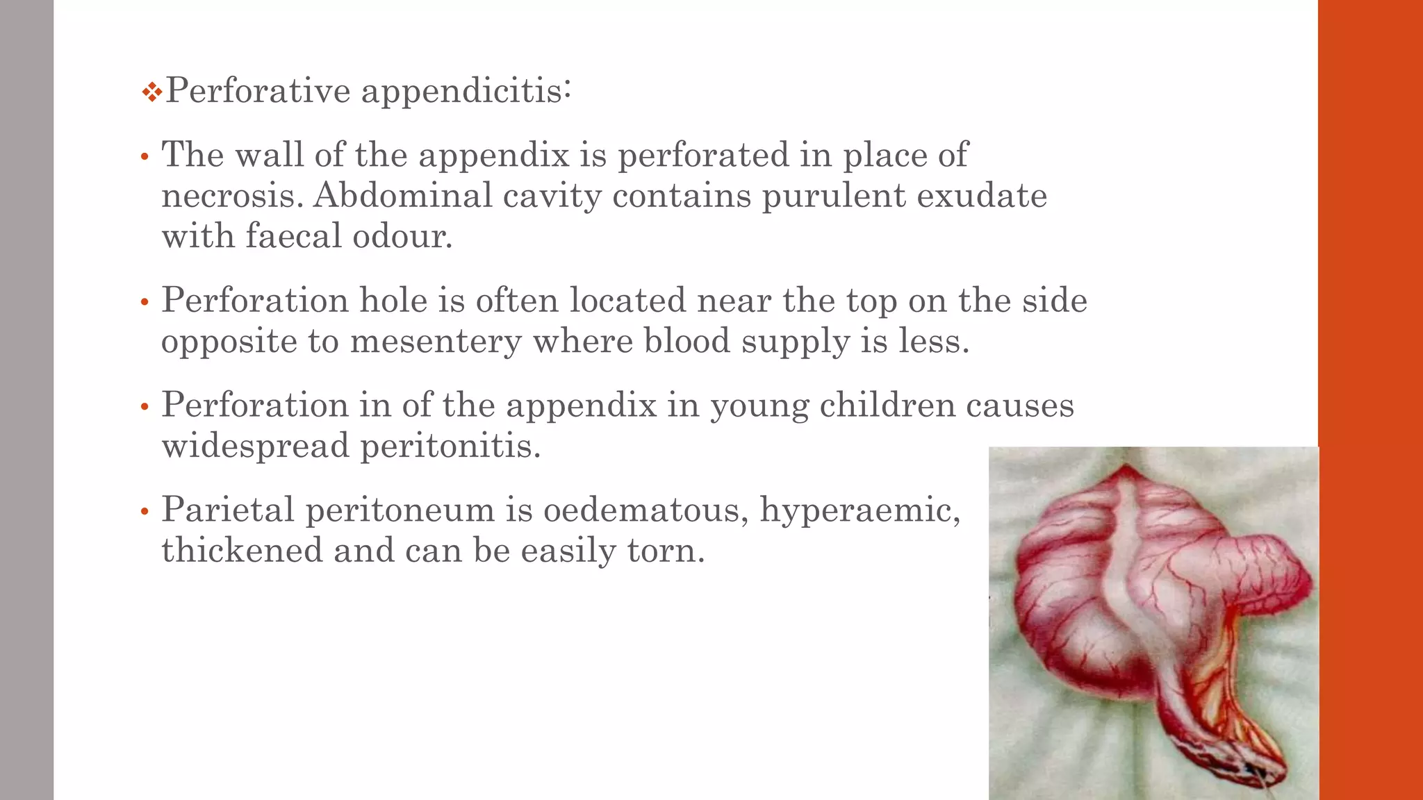 Appendix | PPTX