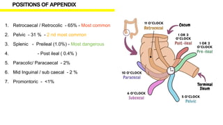 Acute Appendicitis | PPTX | Digestive Disorders | Diseases and Conditions